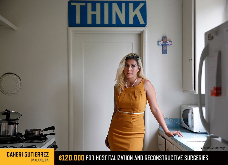 This Is What It’s Really Like to Survive a Gunshot – Mother Jones